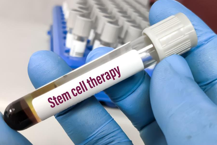 KMC first in Qatar to offer stem cell therapy to public