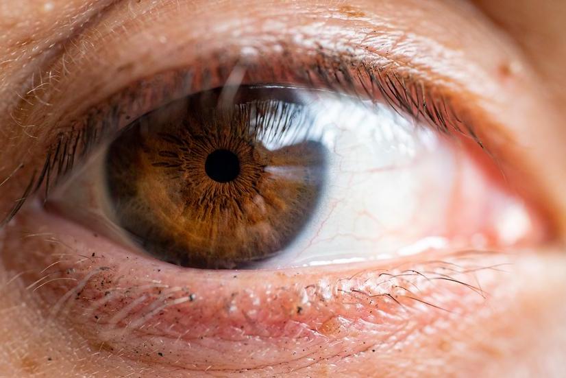 Corneal transplants are safer and more precise than ever at Barraquer ...